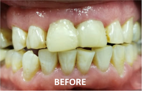 Dr. John Lee DDS | Kids & Grownups Dental | Before and After Photos